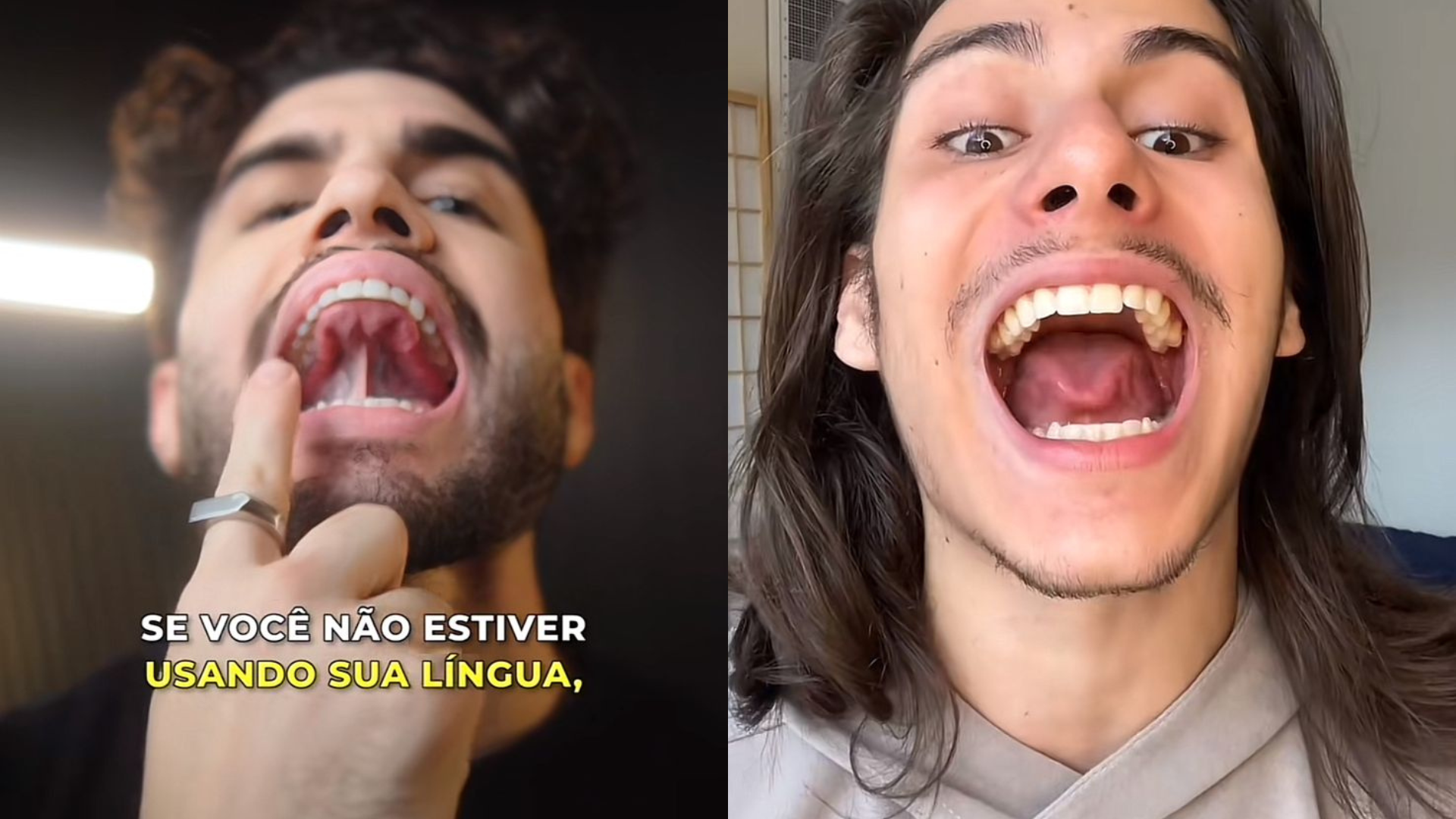 Mewing define o mandíbula? Conheça riscos do exercício viral do TikTok ...