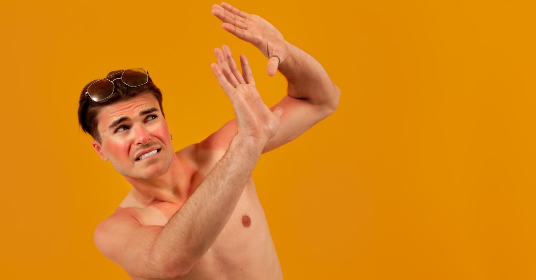 Acne solar: o que é, quais os sintomas e com... - Com Saúde Brasil