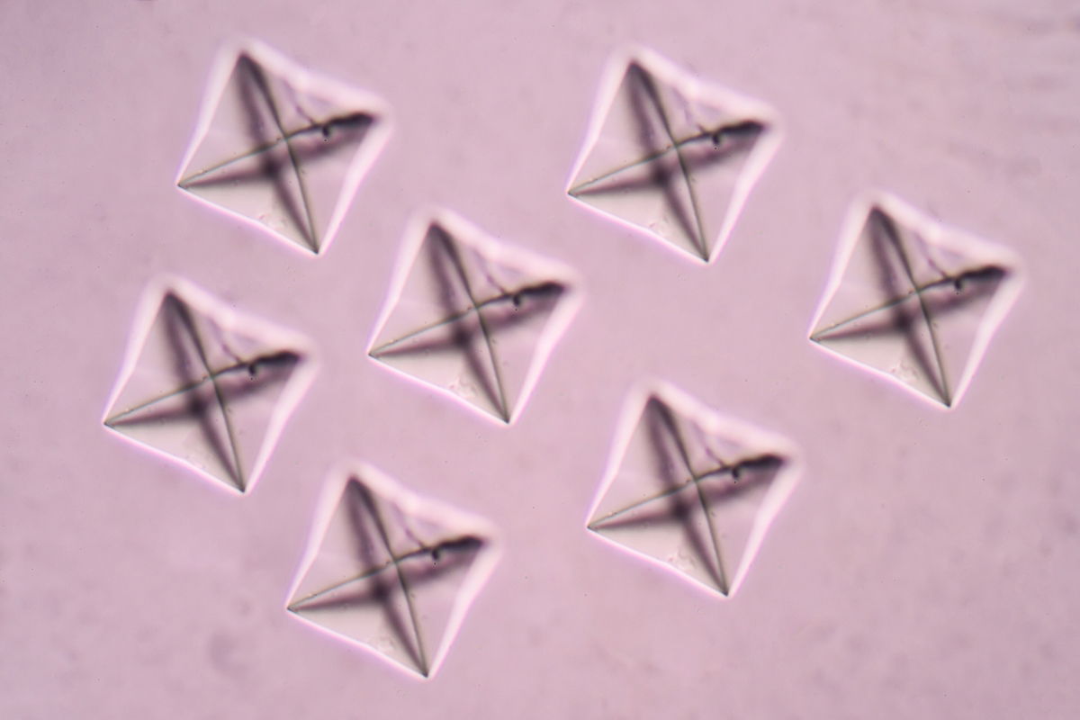 Oxalato de cálcio na urina: o que pode ser (e o que fazer) - Com Saúde ...